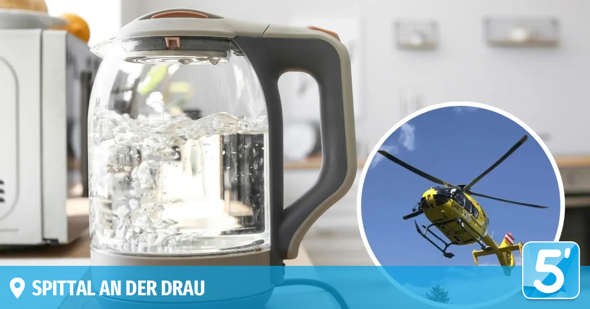 Tragischer Unfall: Einjähriger übergießt sich mit kochendem Wasser